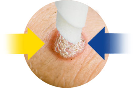 Verrukill GEL HI TECH PEN - Verrukill