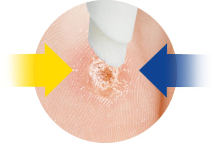 Verrukill GEL HI TECH PEN - Verrukill