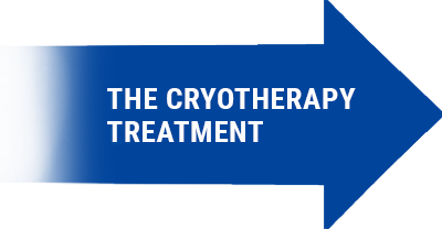 Verrukill CRYO the cryoterapy treatment - Verrukill